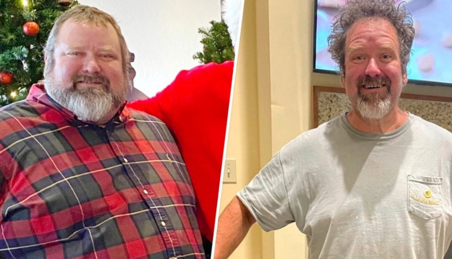 Ecja e përditshme e ndihmoi amerikanin të “heqë qafe” 101 kilogramë