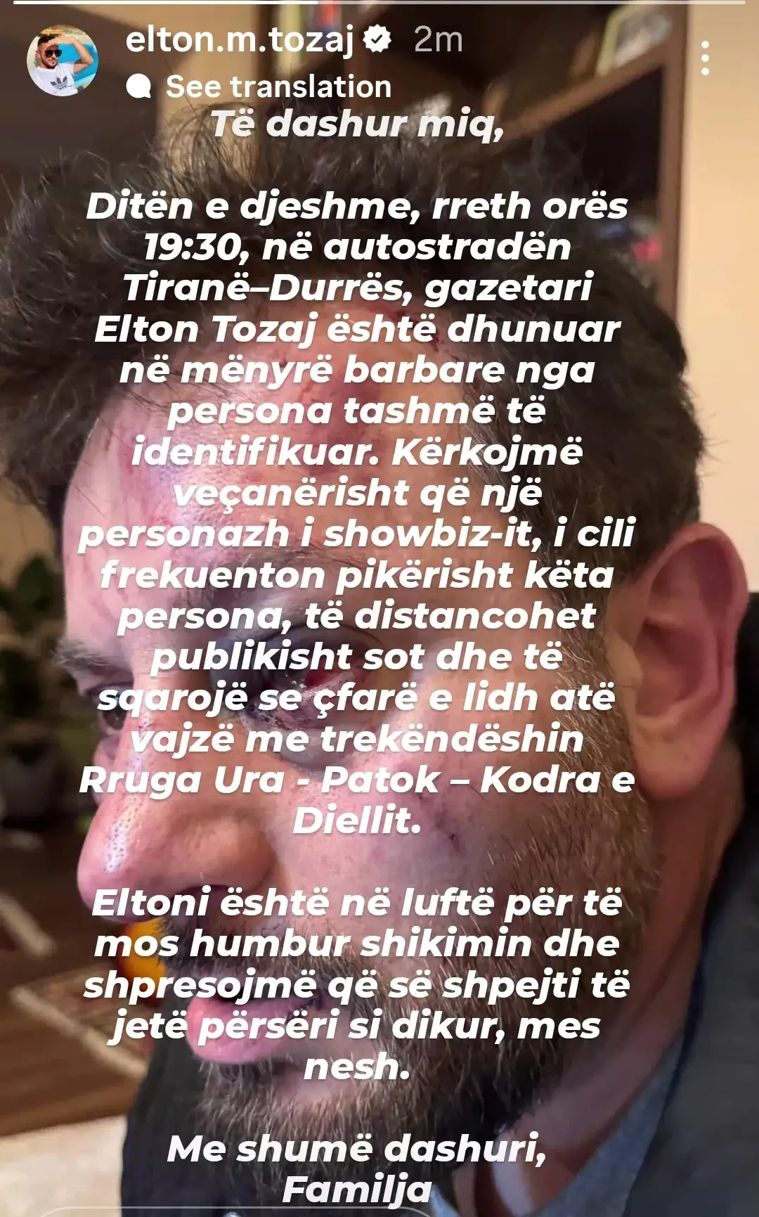 Rrahet gazetari shqiptarë, familja: Rrezikon të humbasë shikimin